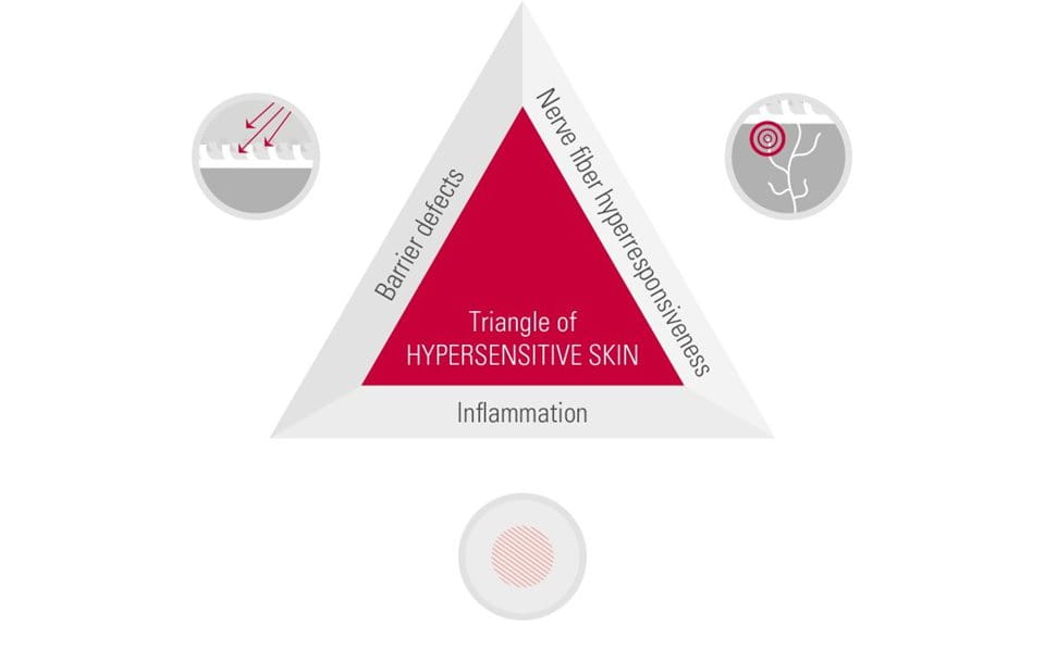 Hypersensitive skin: causes, symptoms, triggers, and solutions ...